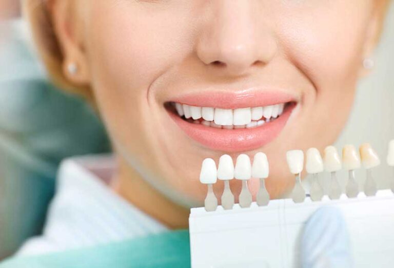 Teeth Whitening - Cheyenne Mountain Dental Care